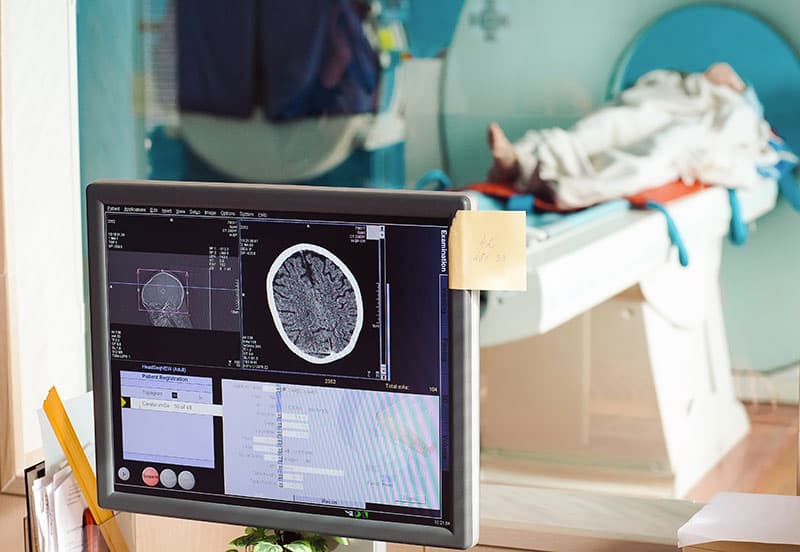 Comprehensive Brain MRI Services in Singapore - VEC Specialists Group